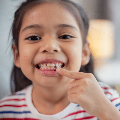 Dental Emergencies Part 2: Broken or Chipped Teeth - Richmond Pediatric ...